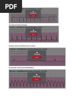 Pre-Evaluacion SVCA ACLS AHA 2015 Con Los Trazados Del EKG y Respuestas ...