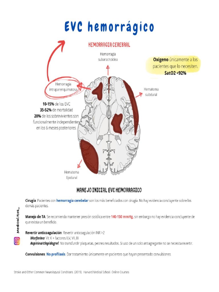 EVC Hemorrágico | PDF
