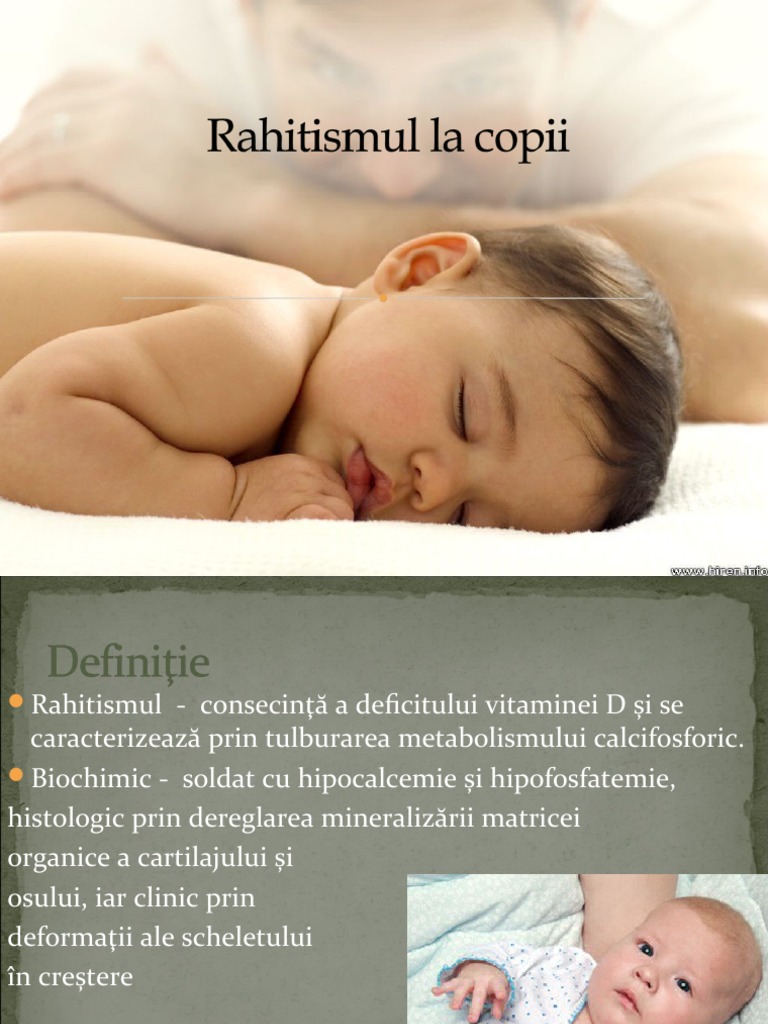 Rahitism Pediatrie | PDF