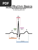 Cardiac Dysrhythmias | PDF | Electrocardiography | Cardiovascular System