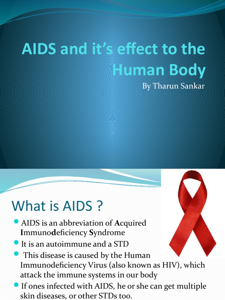 Understanding AIDS: Impact and Insights | PDF | Hiv/Aids | Hiv