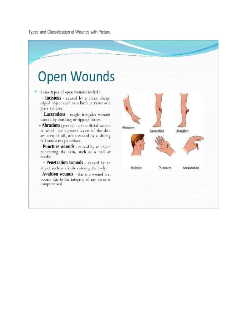 Types and Classification of Wounds With Picture | PDF