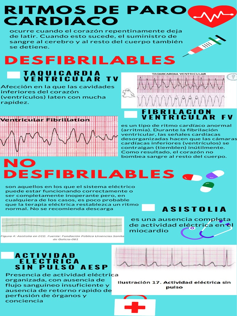 Ritmos Desfibrilables | PDF