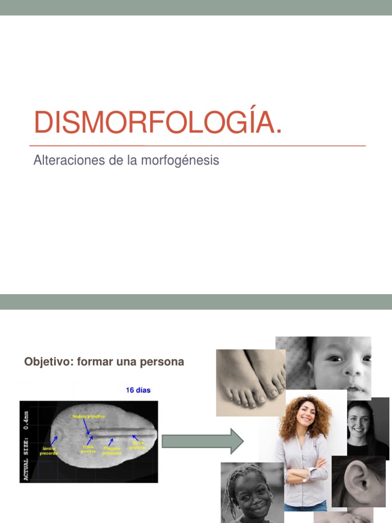 DISMORFOLOGÍA. Presentación | PDF | Ojo humano | Cráneo