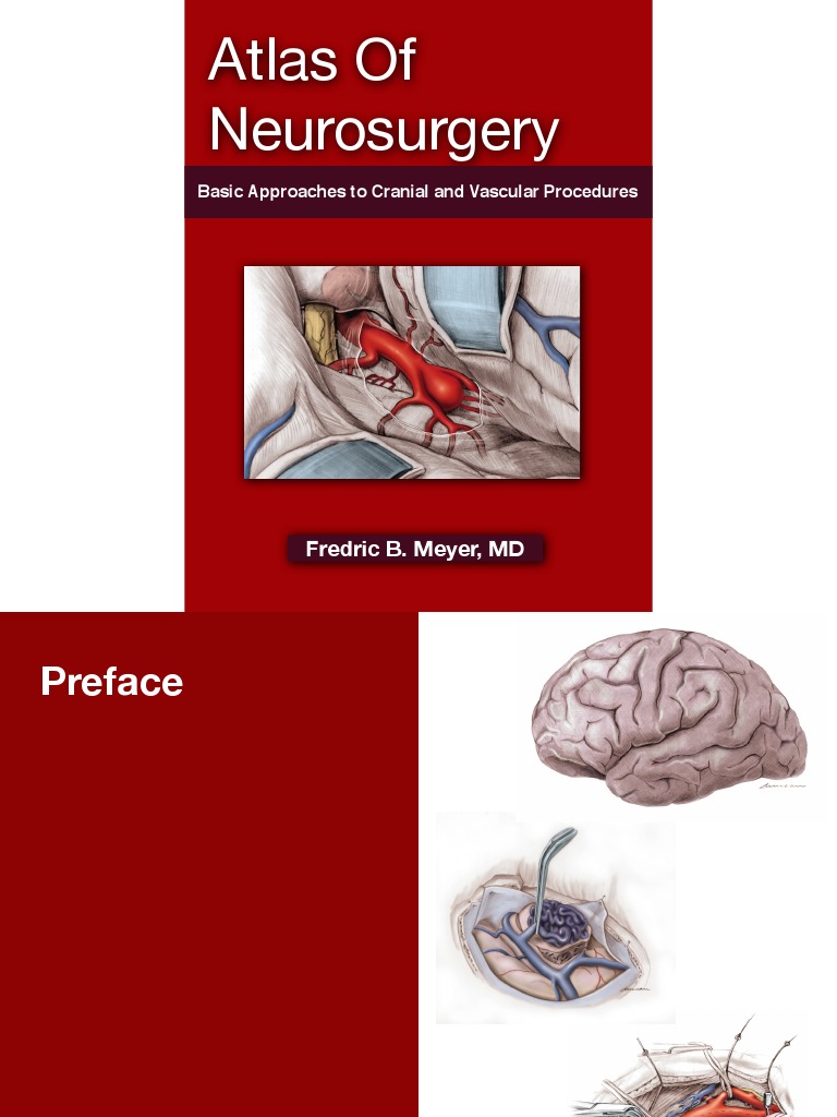Atlas of Neurosurgery Basic Approaches To Cranial and Vascular ...