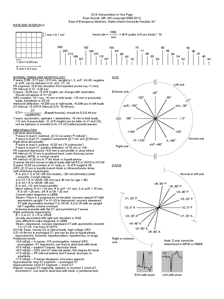 ECG Interpretation in One Page | PDF | Electrocardiography | Heart