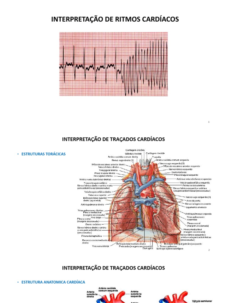 5 Interpretação de Ritmos Cardíacos | PDF | Coração | Eletrocardiografia