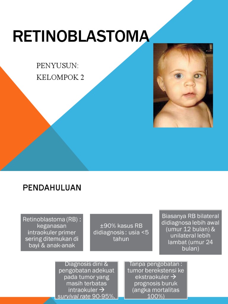 RetinoBlastoma-ppt Kel 2 | PDF