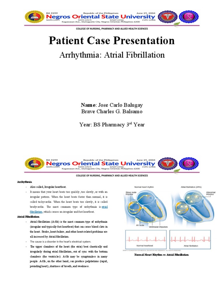 Atrial Fibrillation Case Presentation | PDF | Heart | Physiology