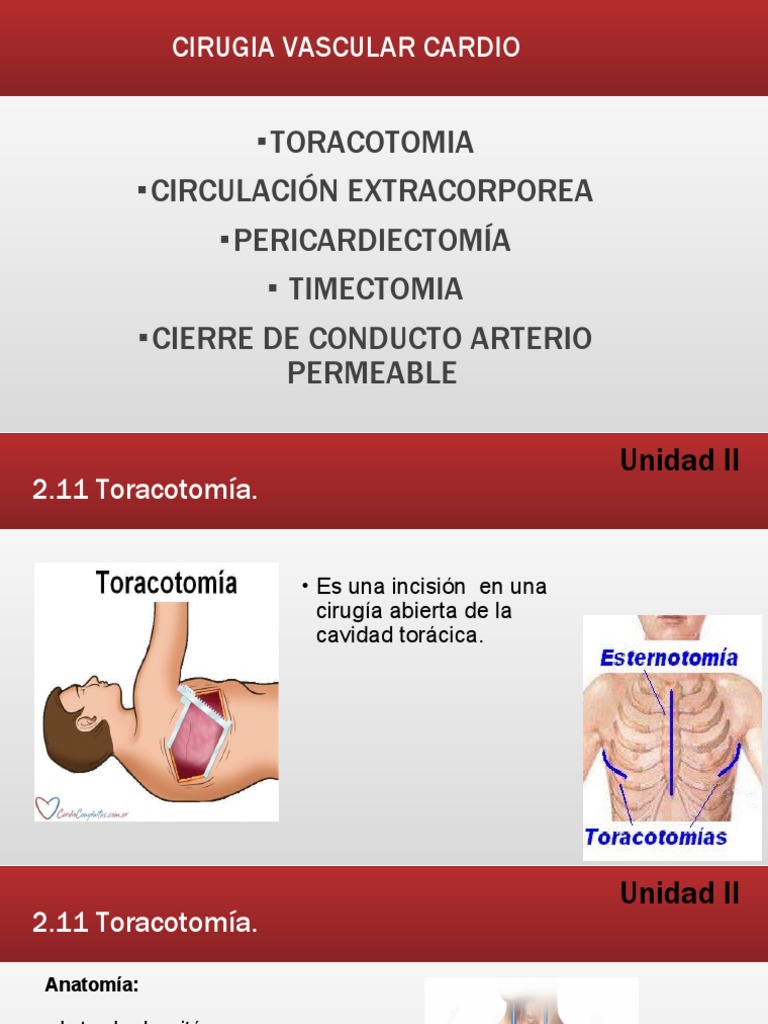 Timectomia, Cierre, Pericardiectomia | PDF | Corazón | Anatomía humana