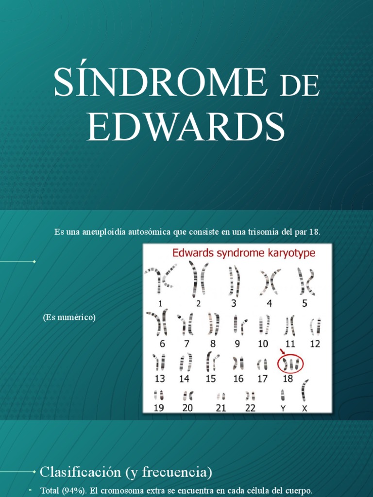 S7. Sindrome de Edwards | PDF