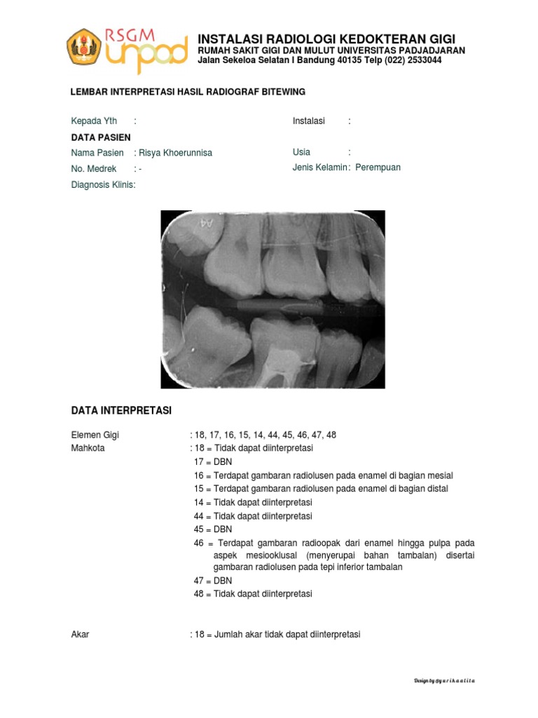 Interpretasi Radiografi Gigi Bitewing | PDF