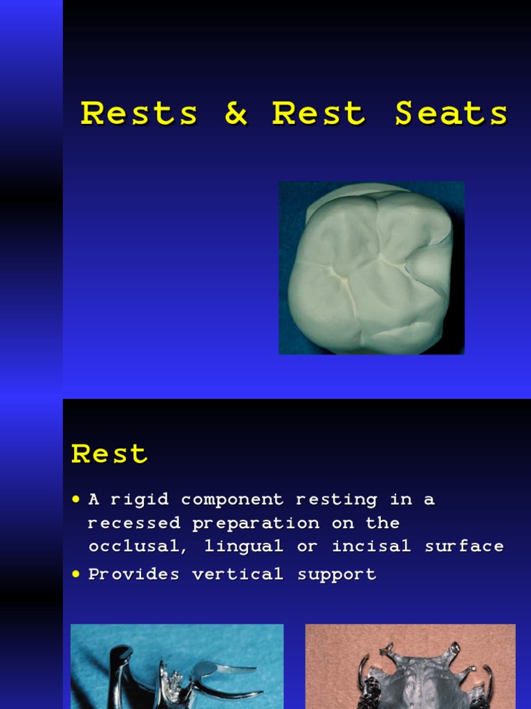 A Comprehensive Guide to Rests and Rest Seat Preparations for Removable ...