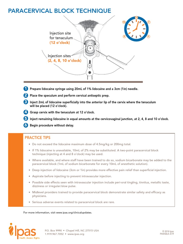 Paracervical Block Technique: (12 O'clock) | PDF