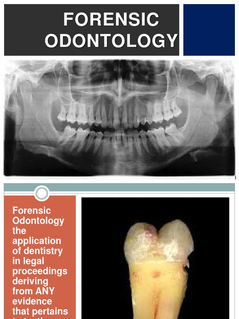 Forensic Odontology Dental Basics and Analysis | PDF | Dental Anatomy ...
