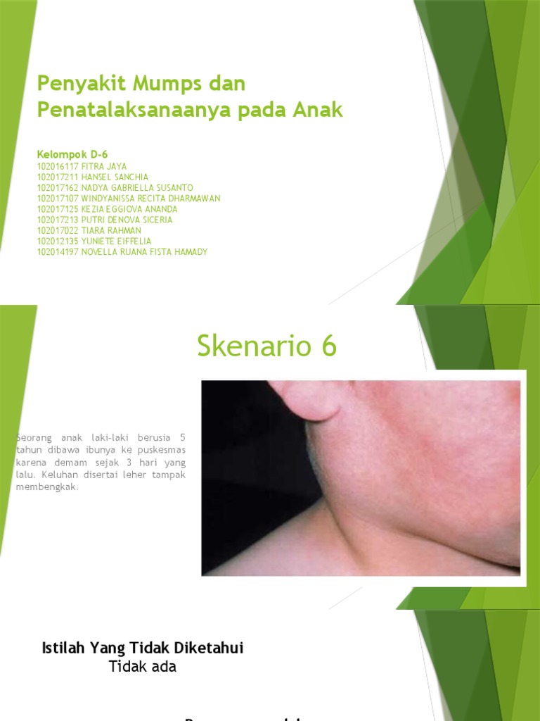 Penanganan Penyakit Mumps pada Anak | PDF