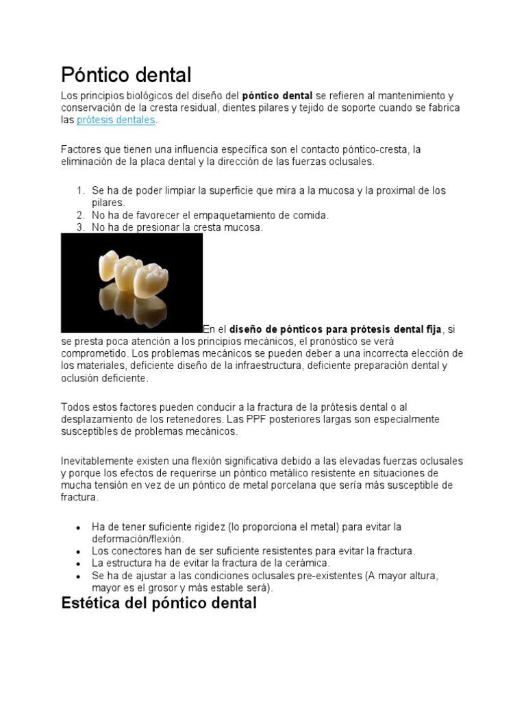 Póntico Dental | PDF | Dentadura postiza
