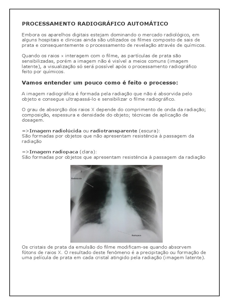 Processamento Radiográfico Automático | PDF | Materiais | Química