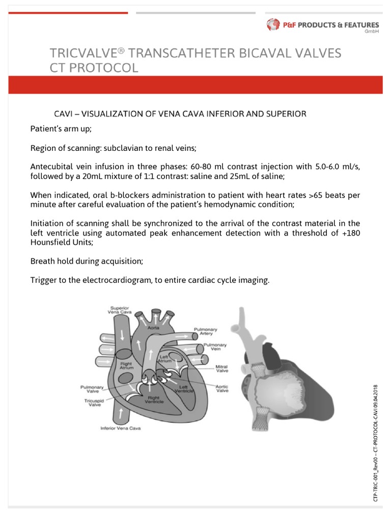 TricValve CT Protocol PDF | PDF