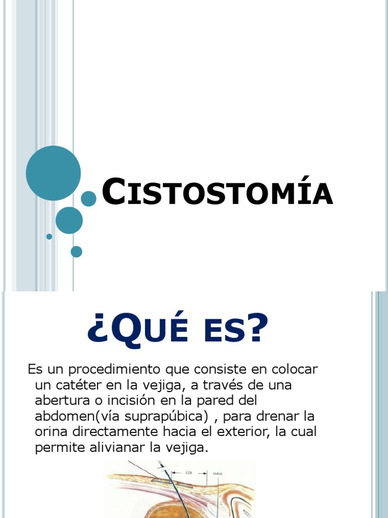 Cistostomía | PDF | Vejiga urinaria | Especialidades Medicas