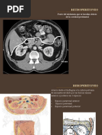 Retroperitoneo: Revisión Anatómica y de La Patología Retroperitoneal ...