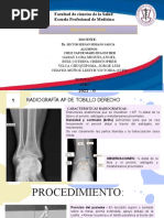 Radiografía de Tobillo Normal AP y Lateral | PDF