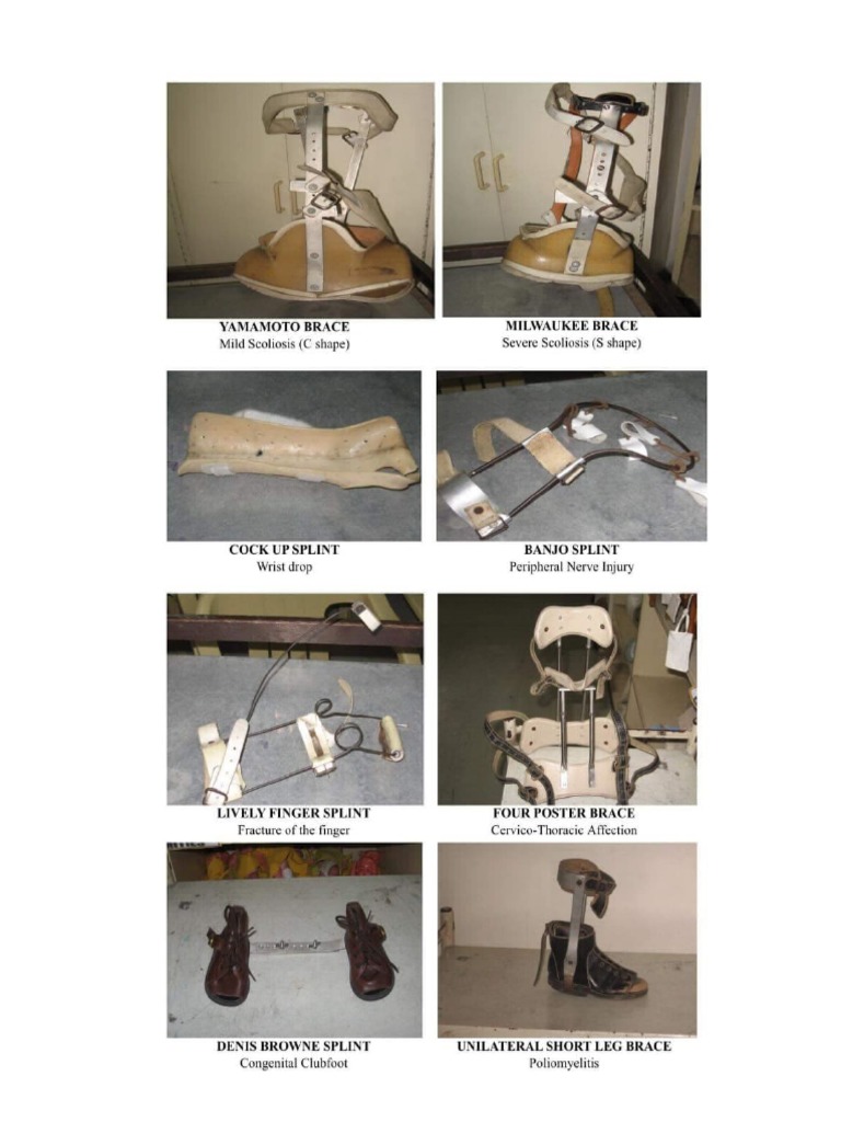 Braces Casts and Traction | PDF
