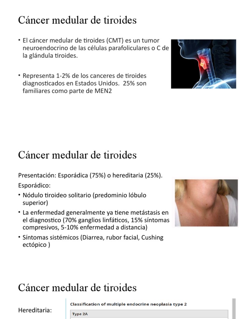 Cáncer Medular de Tiroides | PDF | Cáncer | Metástasis