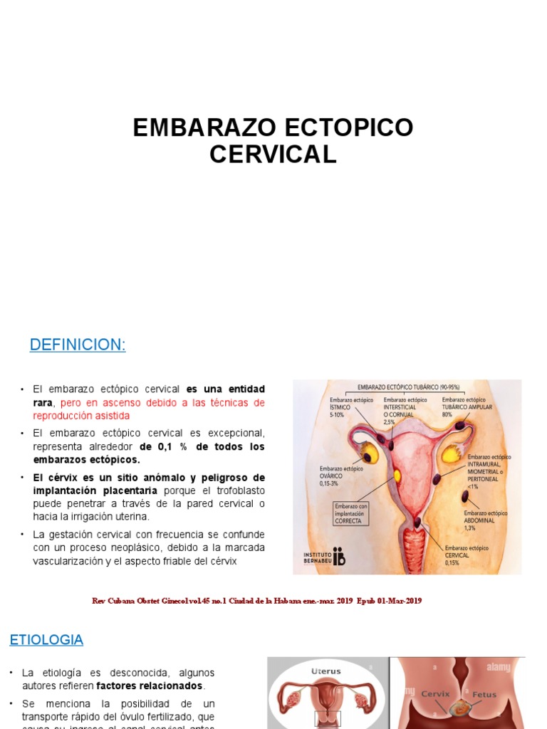 Embarazo Ectopico Cervical Pdf El Embarazo Reproducción Humana