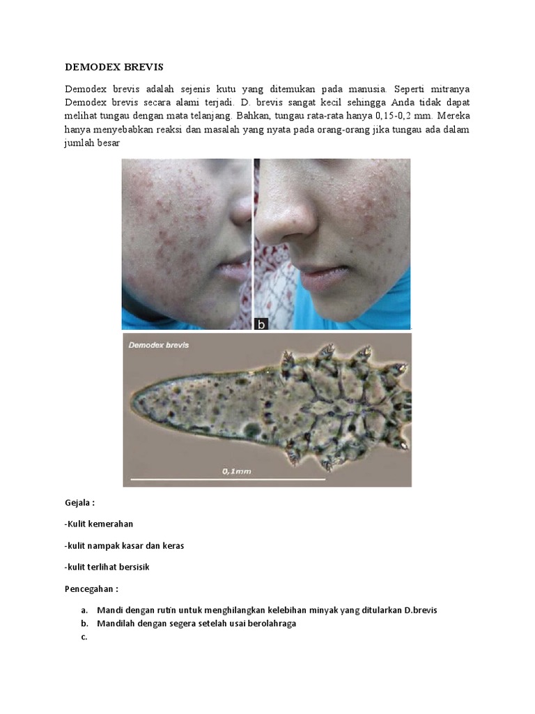 DEMODEX BREVIS Tgs Kulkel | PDF | Kajian Bahasa Asing | Kesehatan Holistik