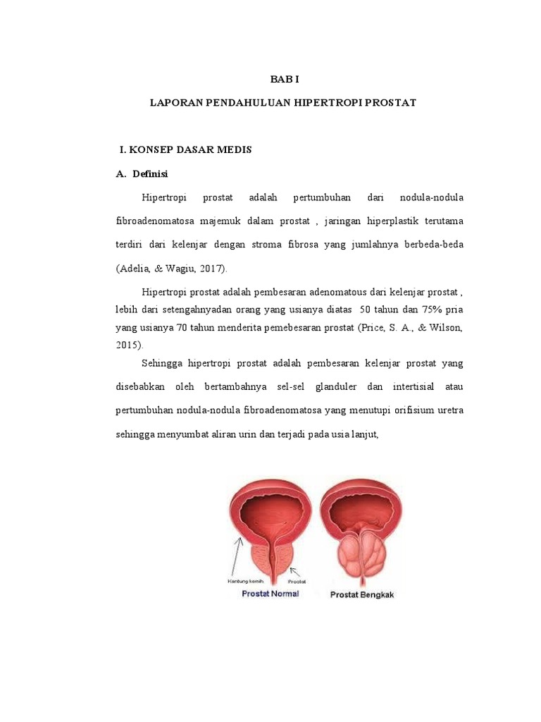 LP Hipertropi Prostat | PDF