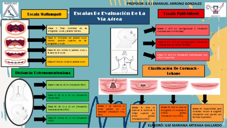 Escalas para Valorar Via Aerea | PDF | Cirugía | Servicios médicos de ...