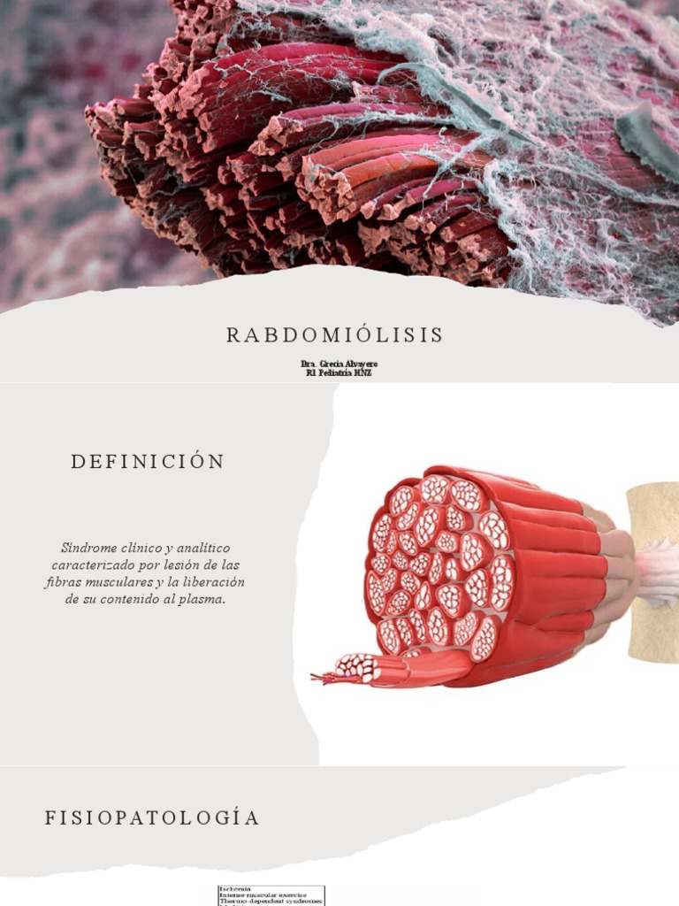 Rabdomiólisis | PDF | Especialidades Medicas | Medicina