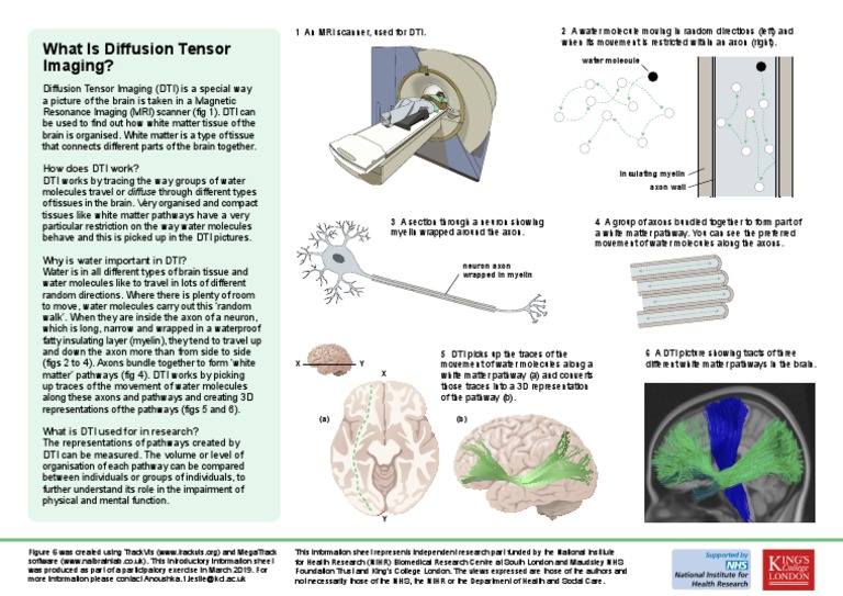 What Is Diffusion Tensor Imaging?: How Does DTI Work? | PDF | White ...