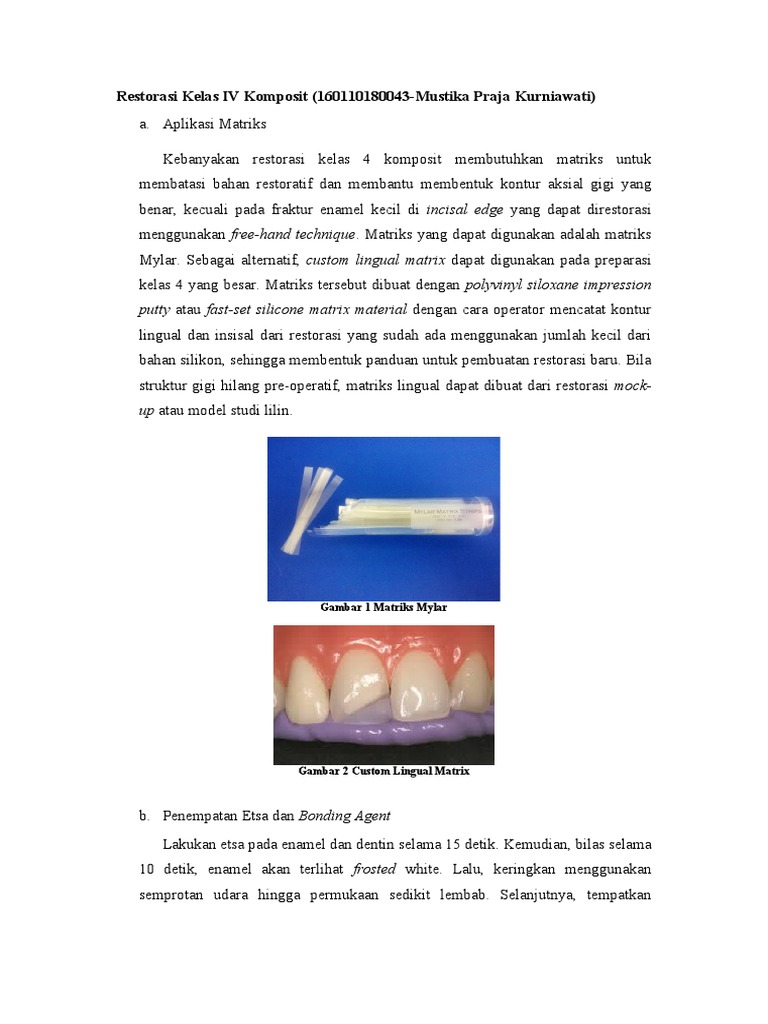Restorasi Kelas IV Komposit | PDF | Griya & Taman