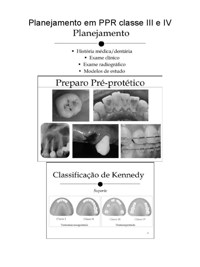Planejamento em PPR Classe III e IV | PDF