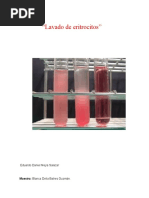 Escala de Killip y Kimball | PDF | Infarto de miocardio ...