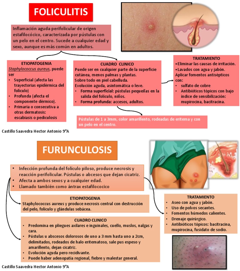 Foliculitis y Furunculosis | PDF | Especialidades Medicas ...