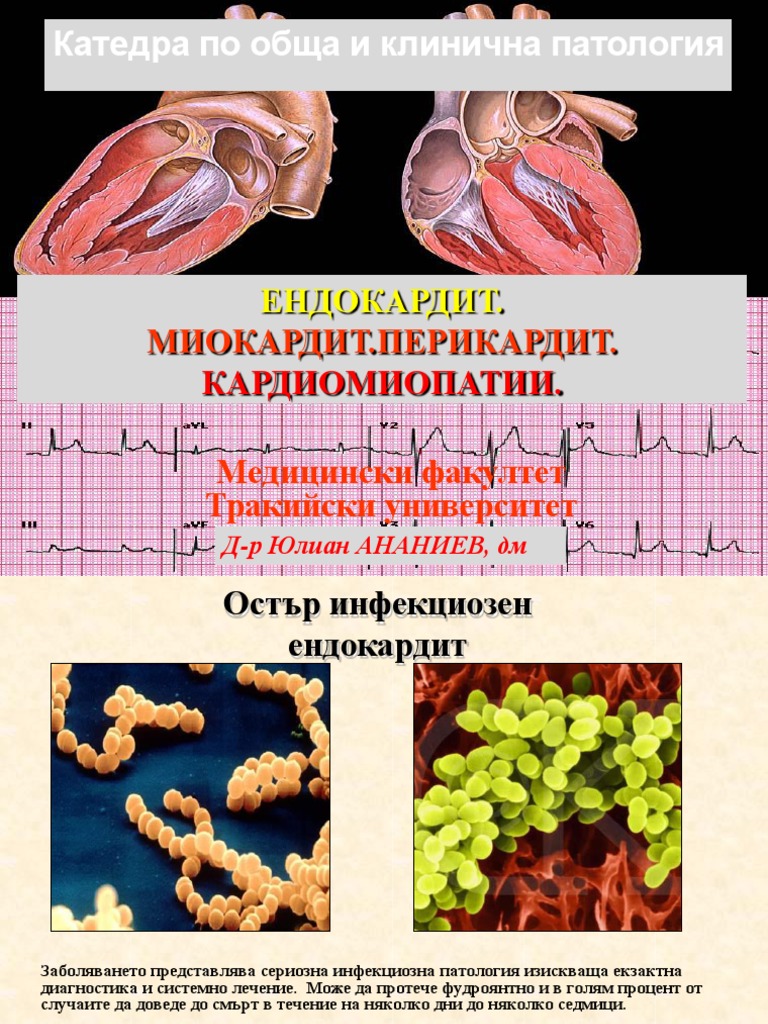 2 - Endo, Myo, Pericarditis | PDF