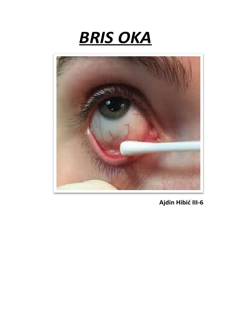 Bris Oka | PDF