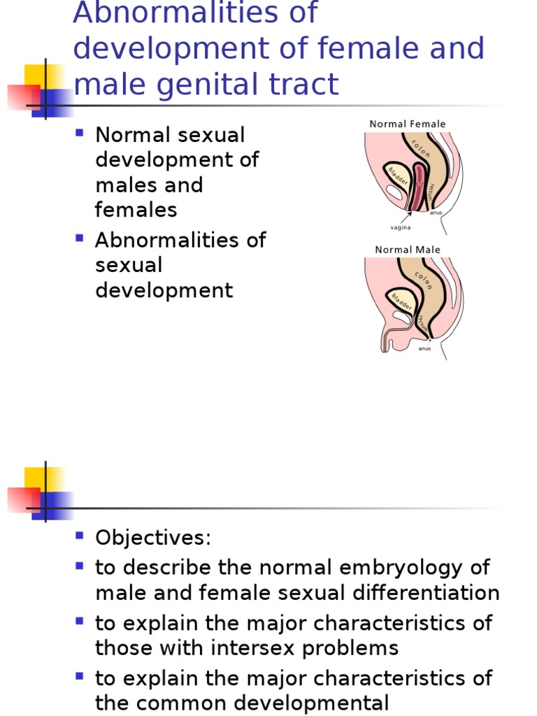 Abnormal Genital Tract Dev | PDF | Sex Organ | Uterus