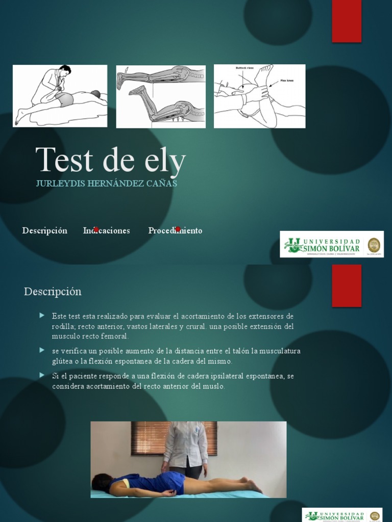 Test de Ely... | PDF