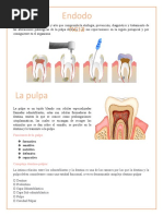 Infografia Abscesos Periapicales | PDF