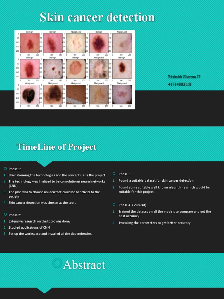 Skin Cancer Detection | PDF | Cancer | Cognitive Science