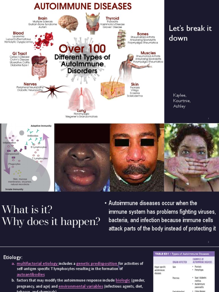Understanding Autoimmune Diseases: Causes & Treatments | PDF ...
