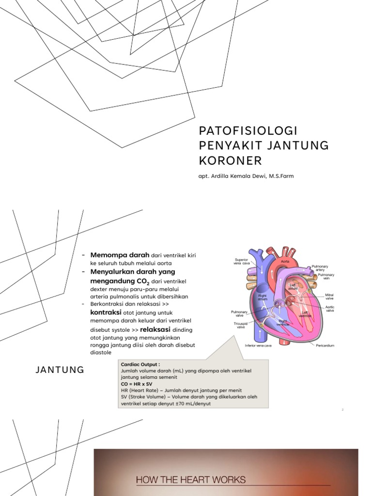 2 - 4. Patofisiologi PJK - Aterosklerosis, Angina, Infark Miokard ...