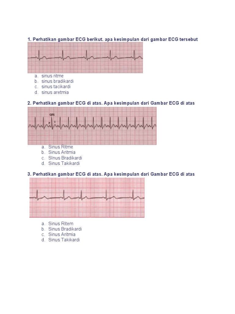 Soal Ecg Anggi | PDF