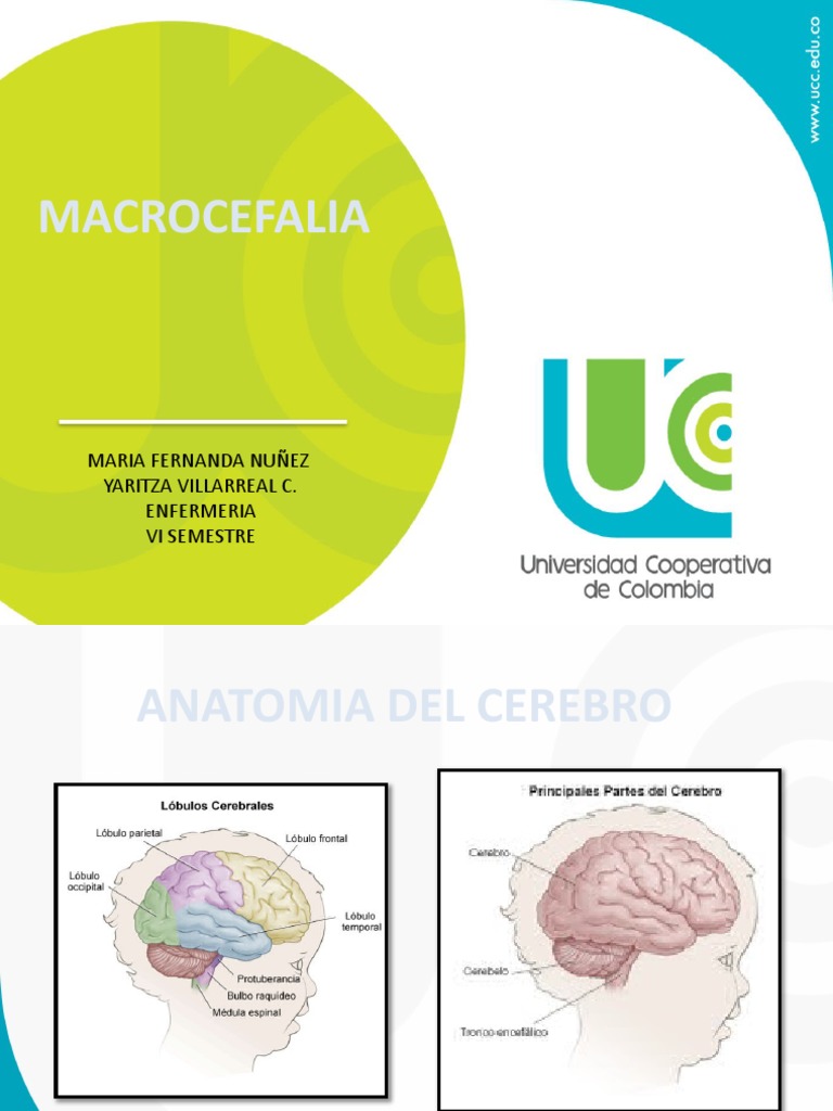 MACROCEFALIA | PDF | Sistema nervioso central | Cerebro