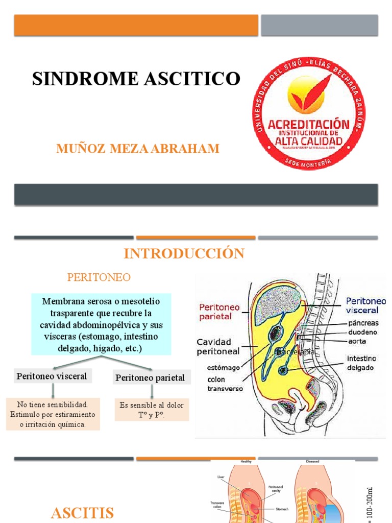 Ascitis: Causas, Diagnóstico y Tratamiento | PDF