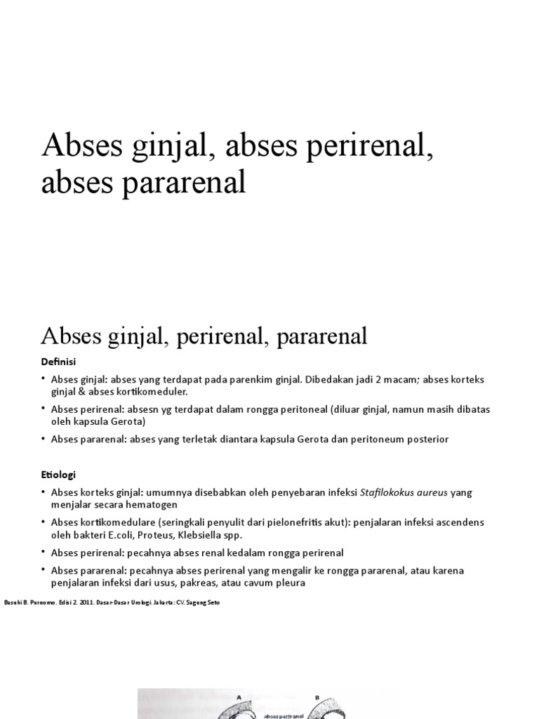 Abses Ginjal: Definisi, Etiologi, dan Tatalaksana | PDF
